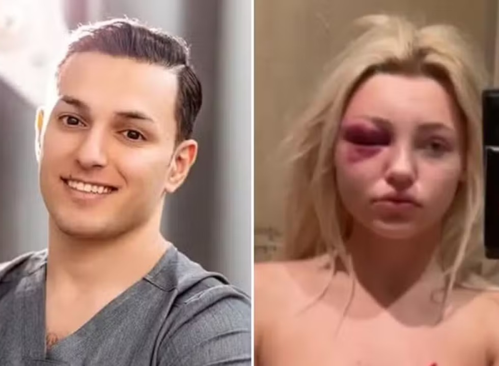 Cirurgião é Acusado De Manter Namorada Como Escrava Sexual E De Forçar Ex A Tomar Hormônios